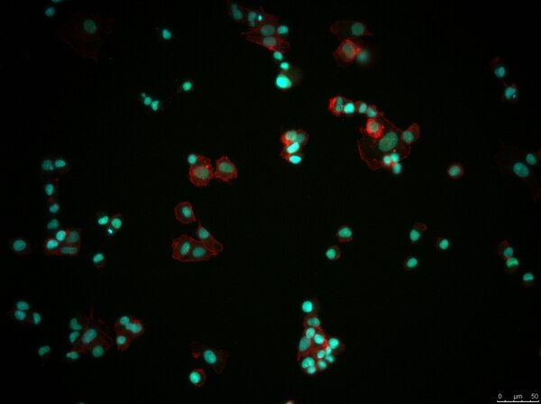 VOA1066 Human Undifferentiated Endometrial Carcinoma Cell Line | SCC489